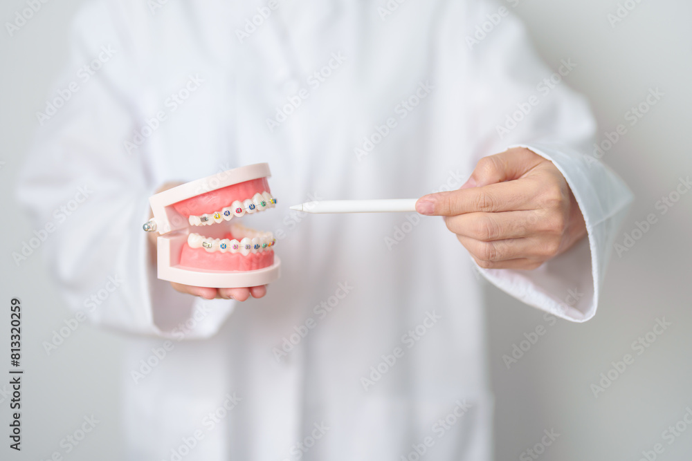 Dentist with Orthodontic tooth model and bracket or brace. Clean and ...