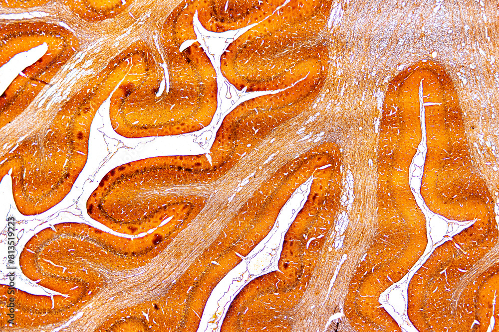 Histological Brain of mouse, Cerebellum, Sympathetic ganglion And ...