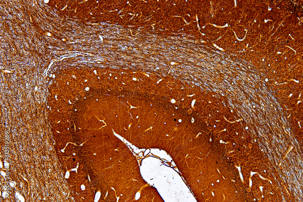 Histological Brain of mouse, Cerebellum, Sympathetic ganglion And ...