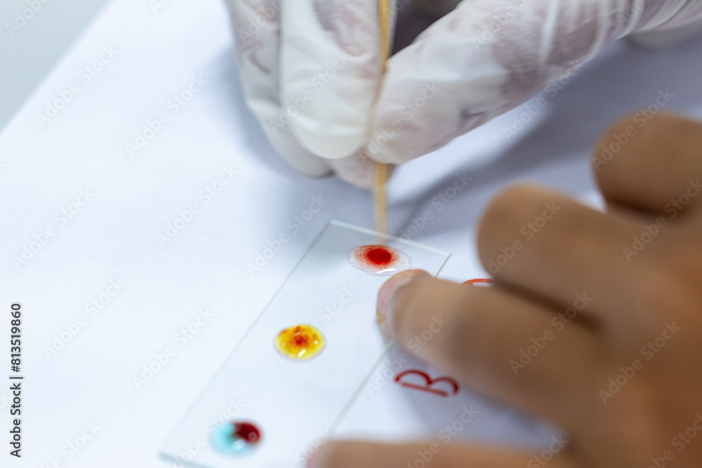 Blood group and rh factor testing by Doctor and Make a permanent slide ...