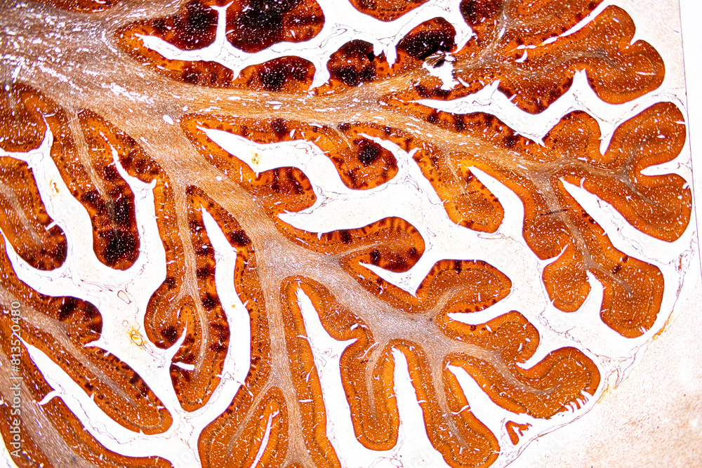 Foto de Histological Brain of mouse, Cerebellum, Sympathetic ganglion ...