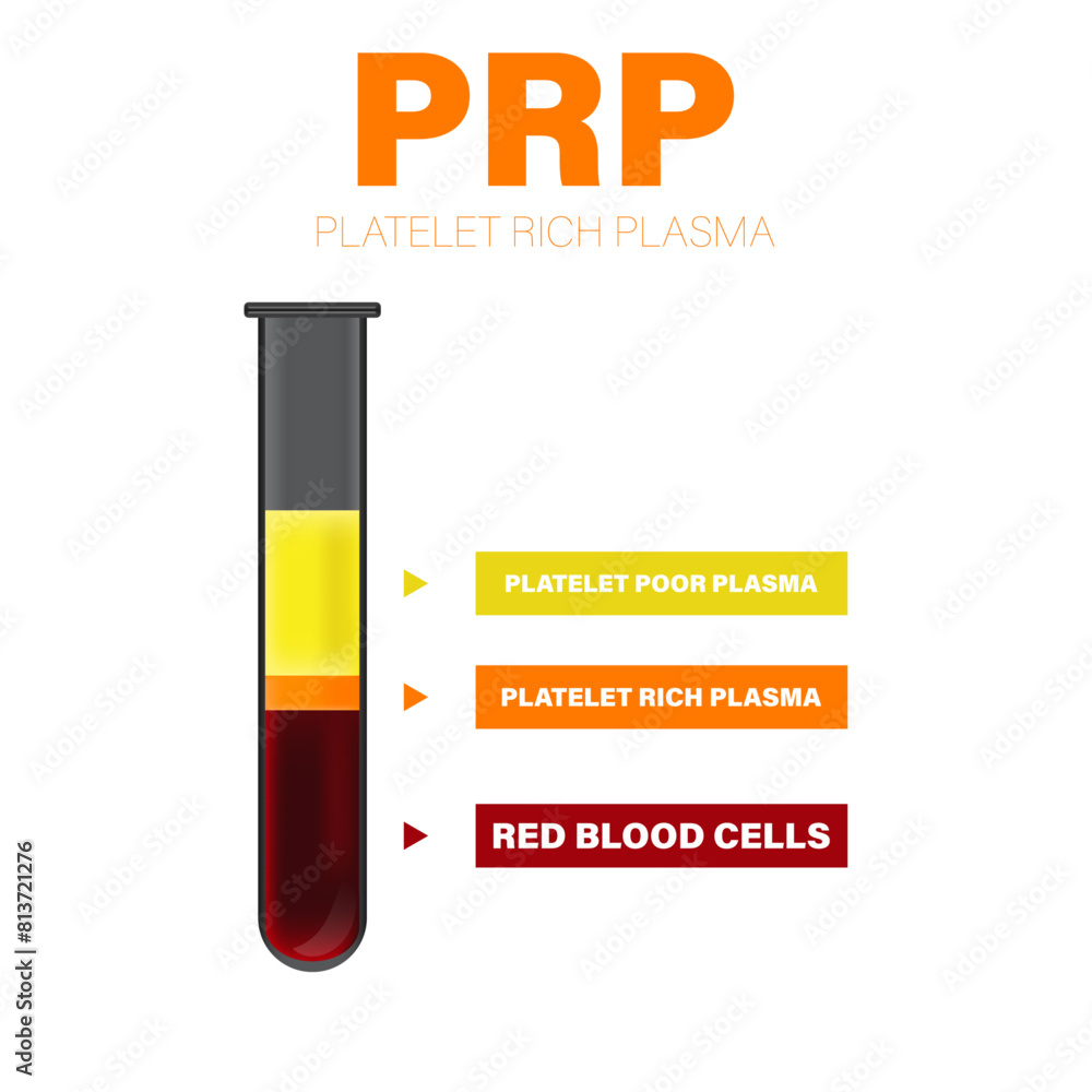 Vector illustration of test tube filled with blood after centrifugation ...