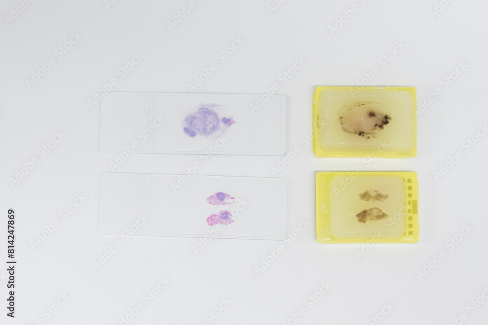 Paraffin box human tissue and glasse slide Hemotoxylin and Eosin stain ...