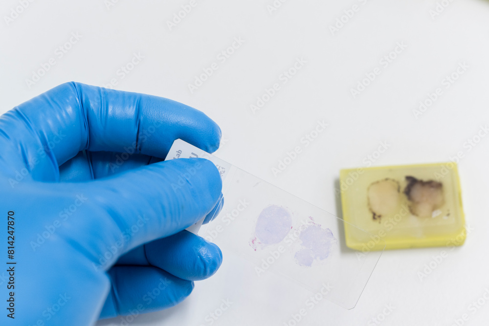 Scientist wear blue glove holding slide and out of focus paraffin human ...
