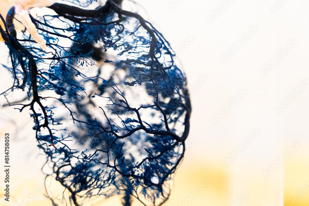 Capillary background, blood vessel, is a medical procedure used to ...