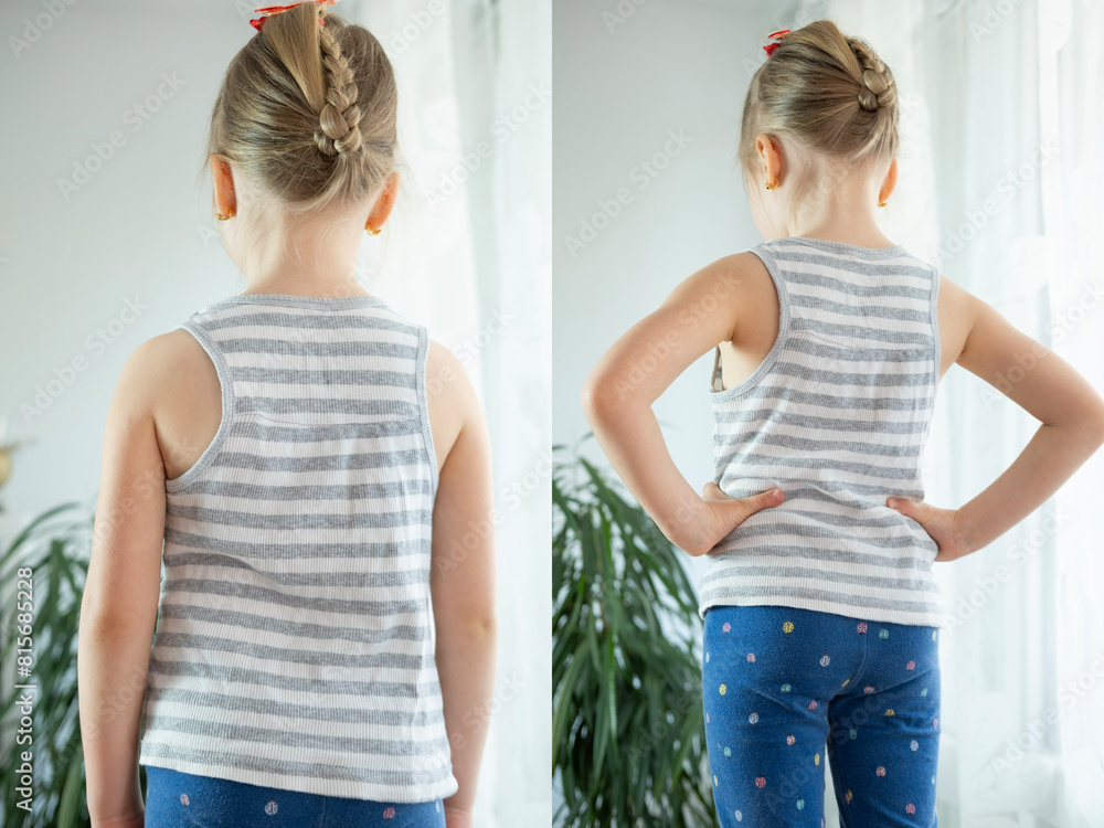 Different views healthy child's back in multiple postures, five-year ...