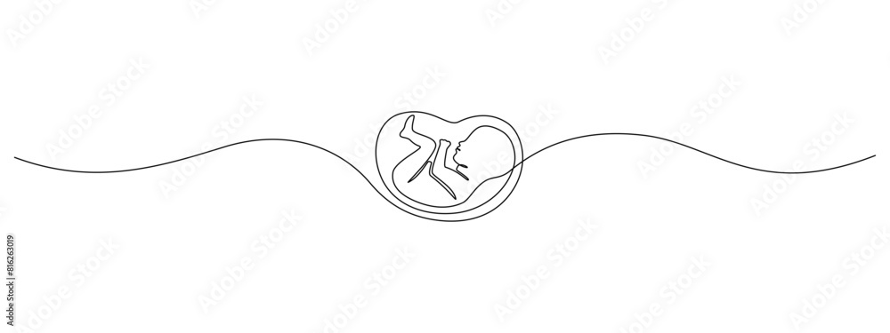 Vetor de Baby embryo in womb in one continuous line drawing. Healthy ...
