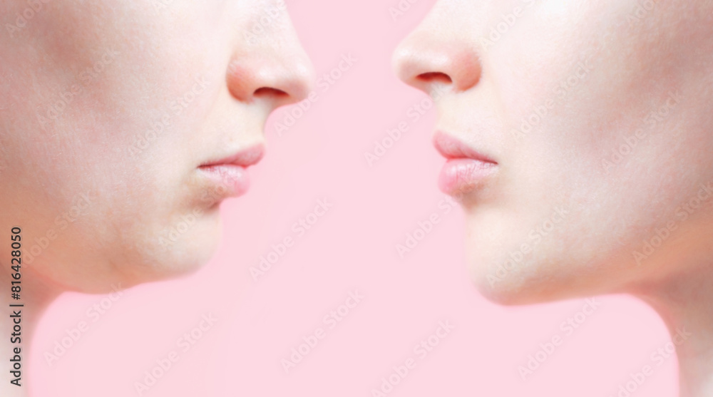 Profile of female face with and without second chin, concept before and ...