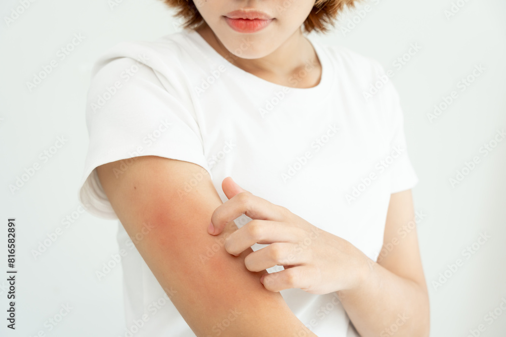 skin problem and beauty. Young woman scratch body has itchy skin from ...