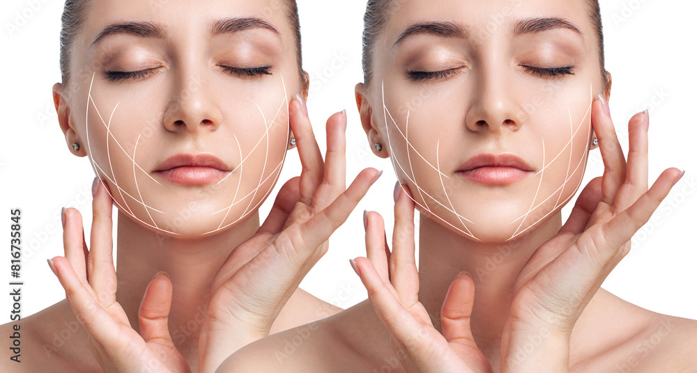 Young woman before and after cheekbones shape correction. Stock Photo ...