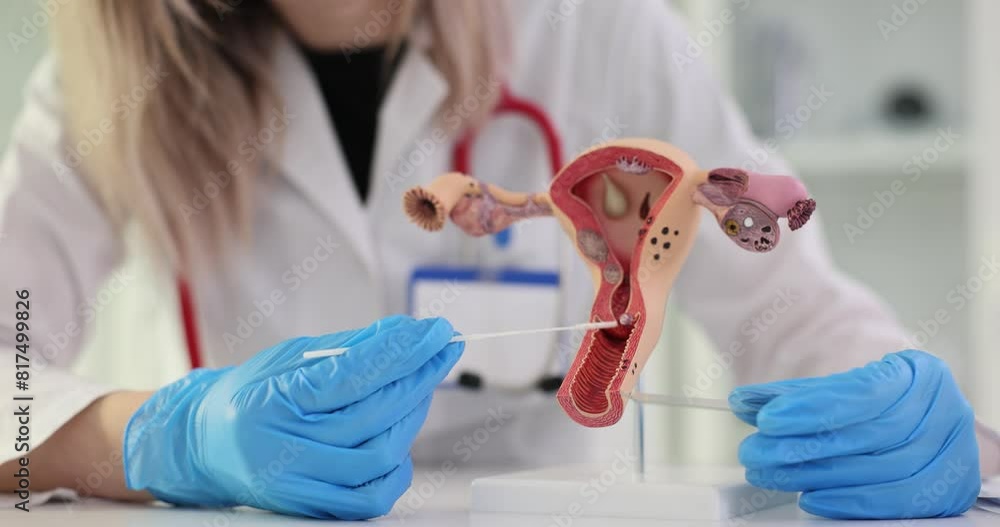 Model of human uterus and cervix taking analysis vídeo do Stock | Adobe ...