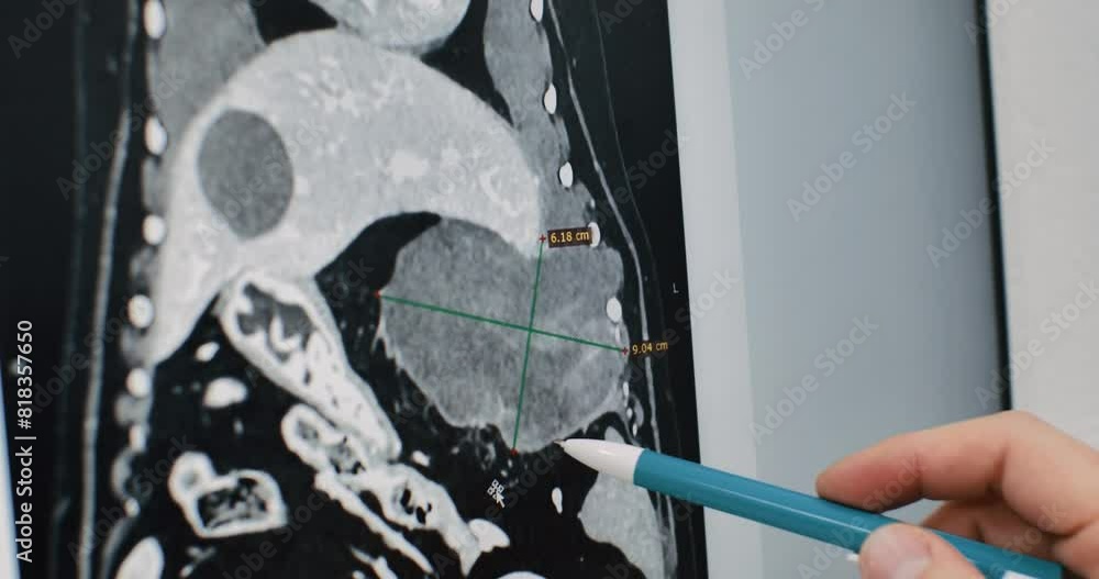 Close-up of an MRI image of an animal A veterinarian's hand shows a ...