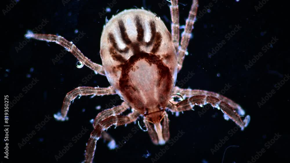 Vidéo Stock Tick detailed close up under the microscope on black ...