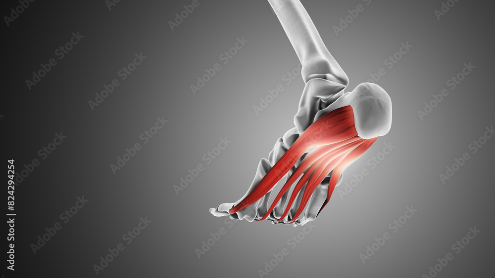 Poster Plantar fascia dysfunction medical animation – Wall Art | UkPosters