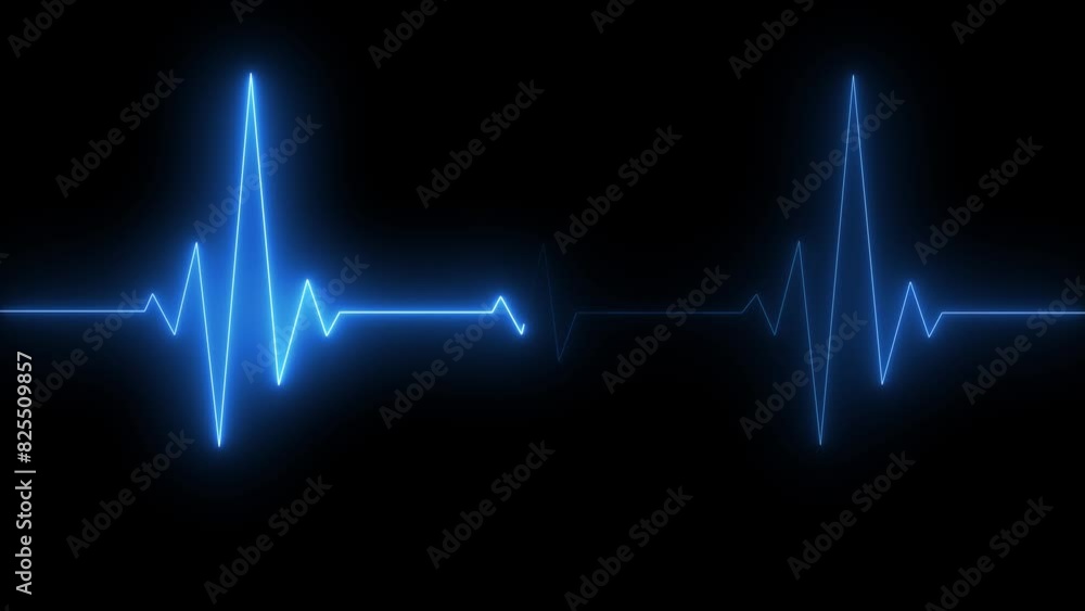 Heart rate monitor electrocardiogram EKG or ECG looping background ...