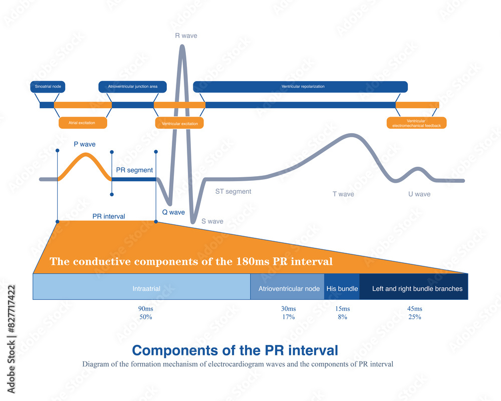 The PR interval of an ecg includes the time during which ...