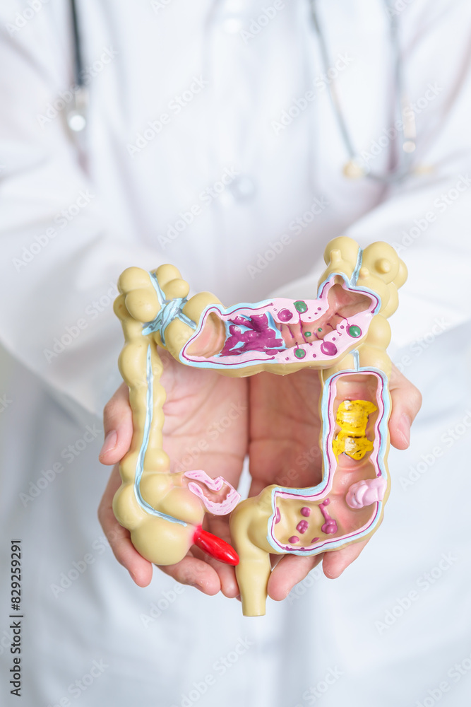 Doctor holding human Colon anatomy model. Colonic disease, Large ...