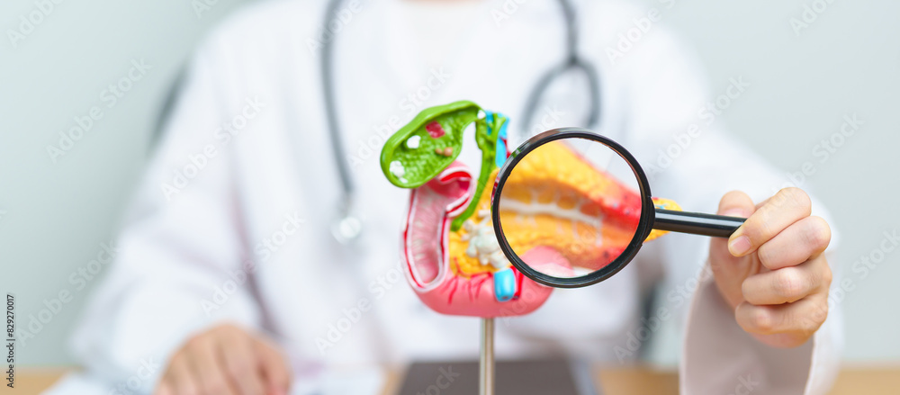 Doctor with human Pancreatitis anatomy model with Pancreas, Gallbladder ...
