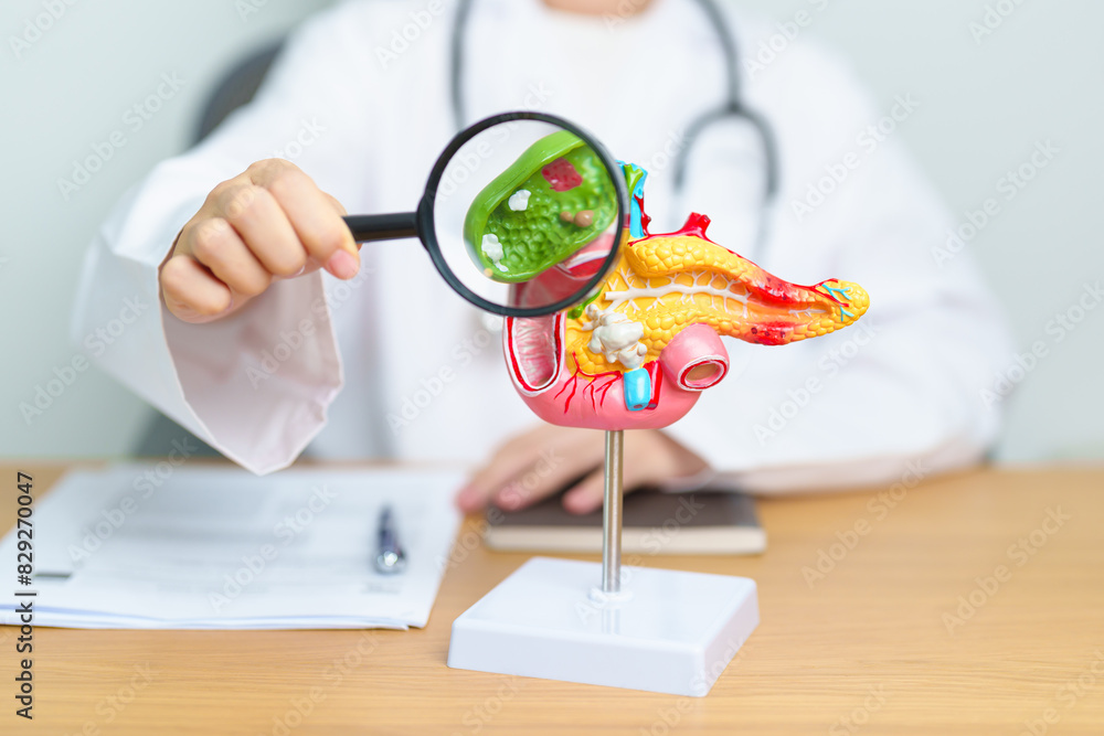 Doctor with human Pancreatitis anatomy model with Pancreas, Gallbladder ...