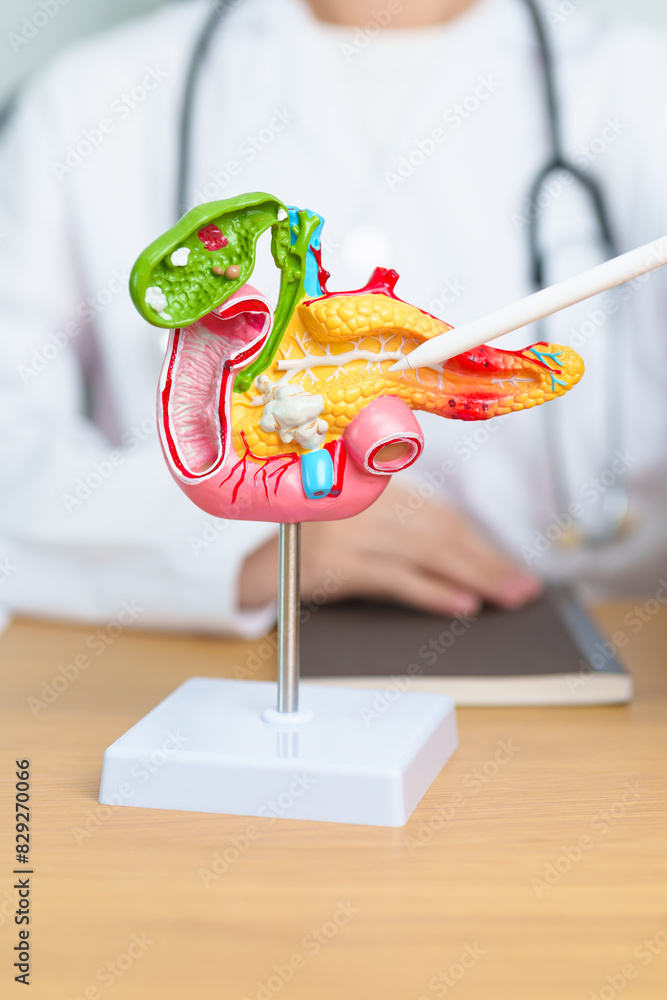 Doctor with human Pancreatitis anatomy model with Pancreas, Gallbladder ...