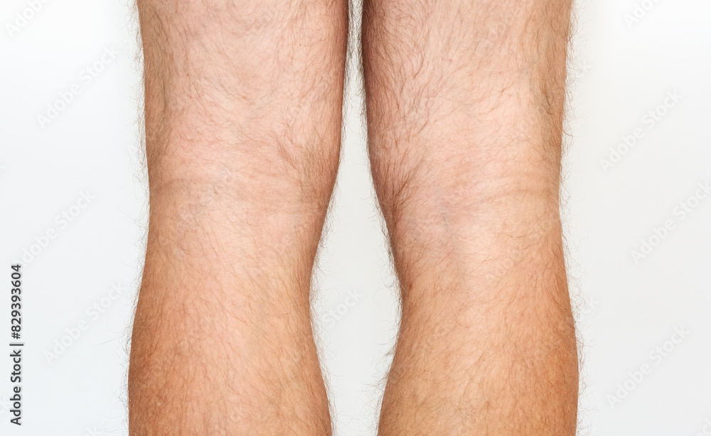 Popliteal fossa. Back view of male's knees on plain background. Graphic ...