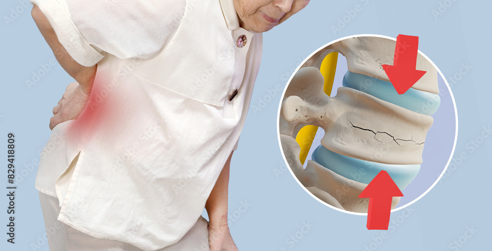 Foto de Back pain and spinal anatomy 3d illustration of elderly women ...
