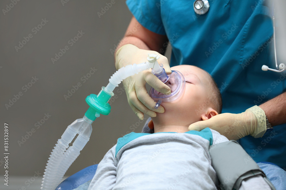 The little boy is under general anesthesia. A breathing tube in the ...