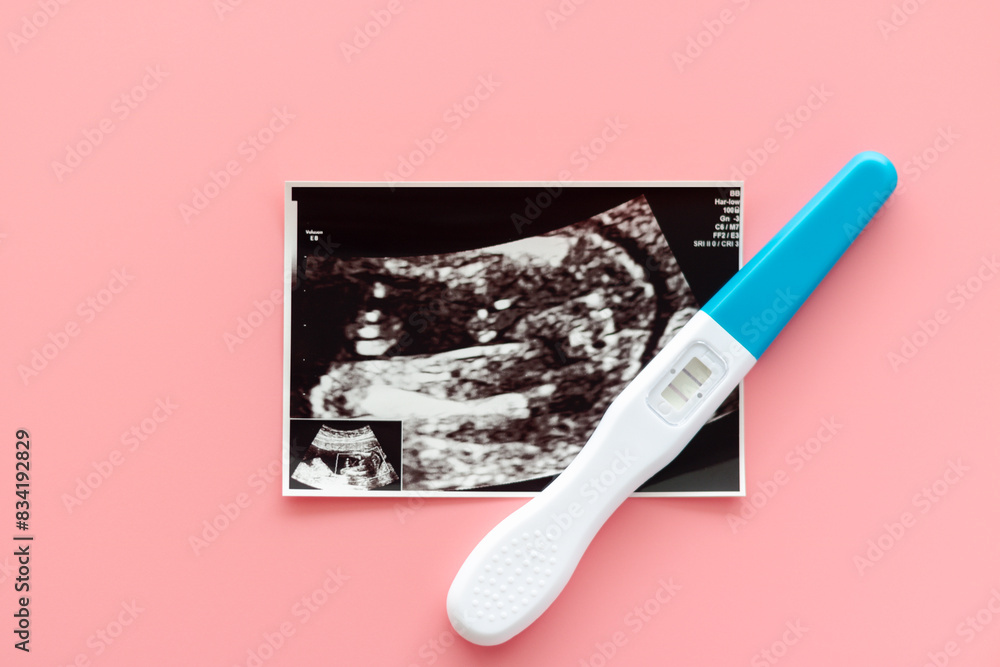Positive pregnancy test. Photo of ultrasound and pregnancy test on a ...
