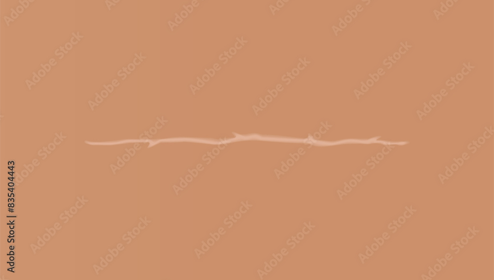 Healing wounds, skin scar, stitched gash and cut. Realistic surgical ...