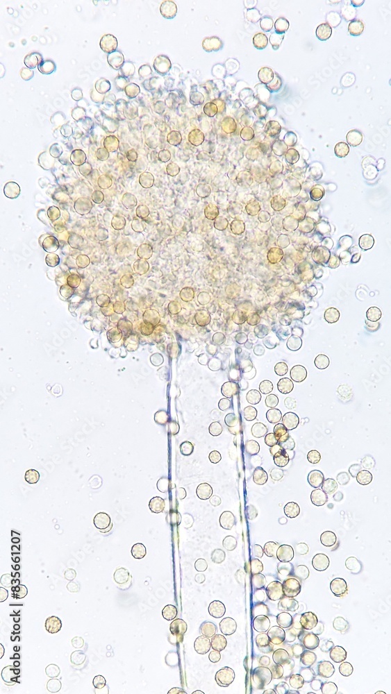Mold species (Aspergillus sp) under microscope. Fresh sample whithout ...