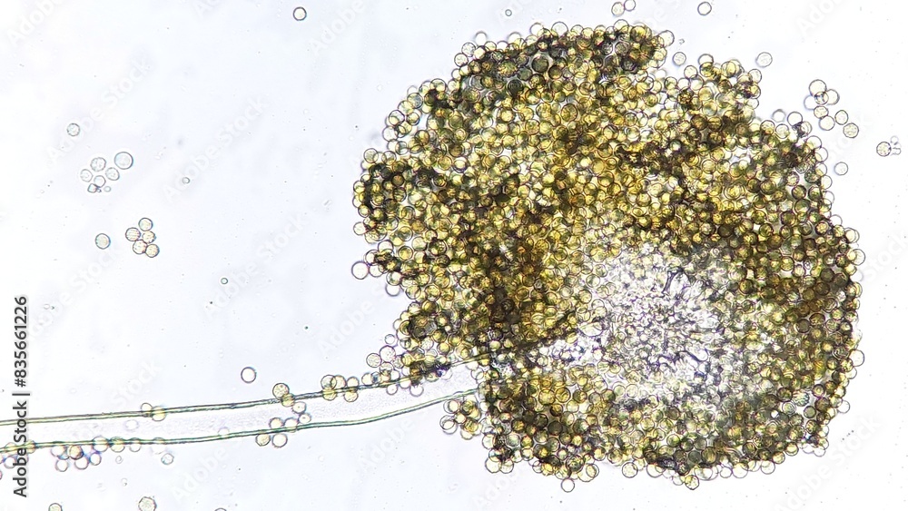 Foto de Mold species (Aspergillus sp) under microscope. Fresh sample ...