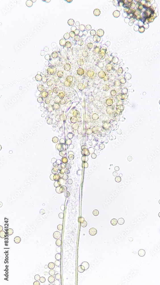 Mold species (Aspergillus sp) under microscope. Fresh sample whithout ...