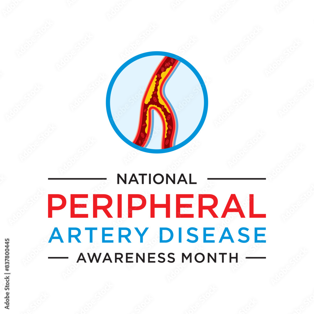 Póster Peripheral Artery Disease (PAD) Awareness Month is an annual ...