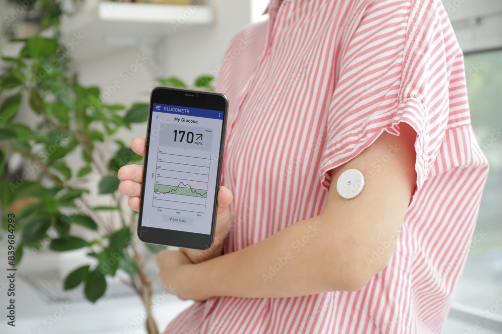 Diabetic young woman with glucose sensor and mobile phone measuring ...