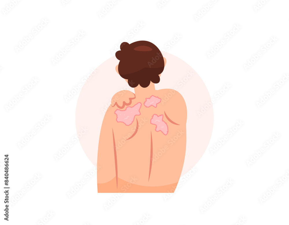 illustration of a man who feels itchy on his back and shoulders ...