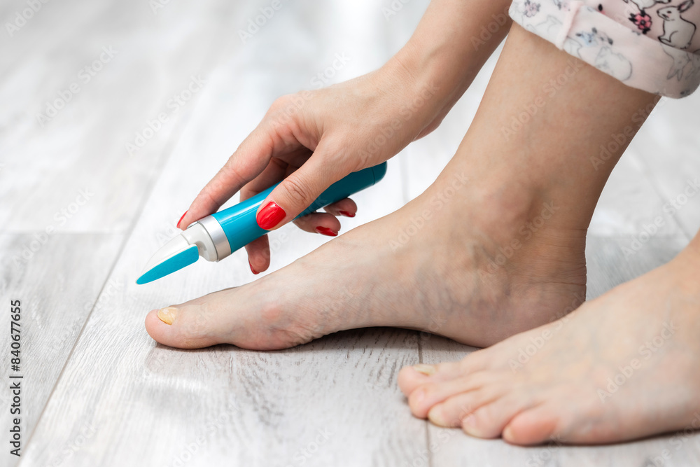 woman sanding her toenails with a sander. woman taking care of toenails ...