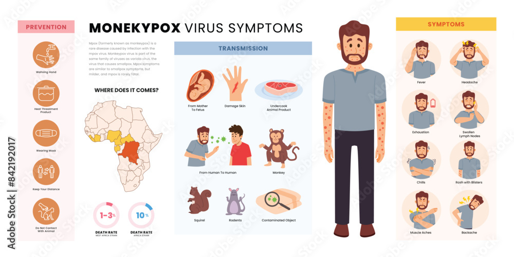 Monkeypox virus infographic medical poster design, labeled Infection, transmission, symptoms ...