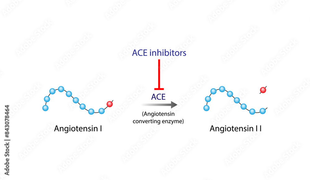 Angiotensin-converting enzyme inhibitors, ACE inhibitors. Angiotensin. Renin-Angiotensin ...