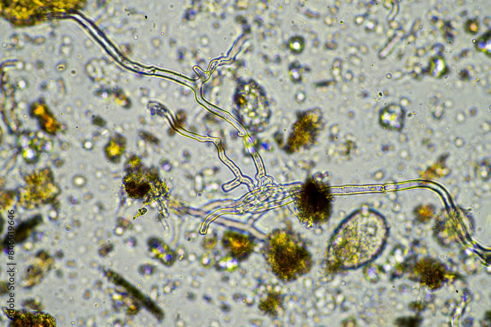 Poster soil microorganisms under a microscope including amoeba ...