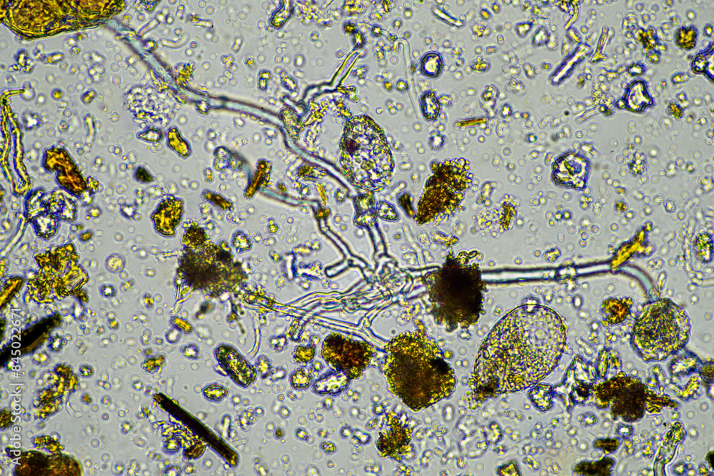 compost microorganisms under a microscope including amoeba, flagellates ...