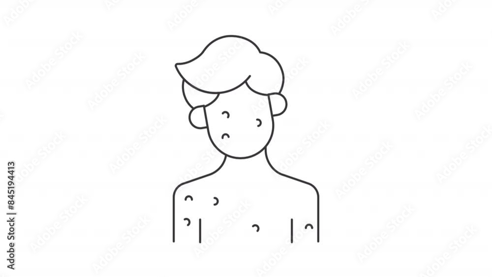 Animated pest bite icon. Bedbugs marks line animation. Skin infection ...