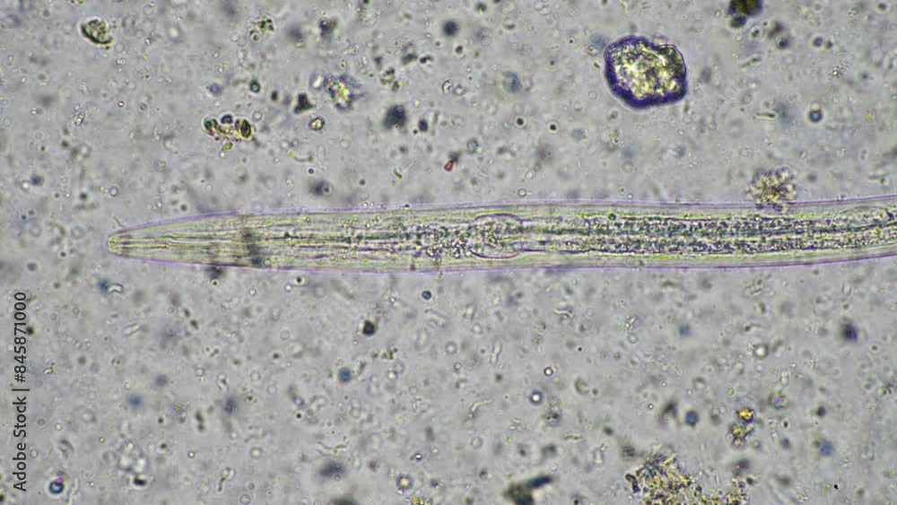 soil microorganisms under a microscope including amoeba, flagellates ...