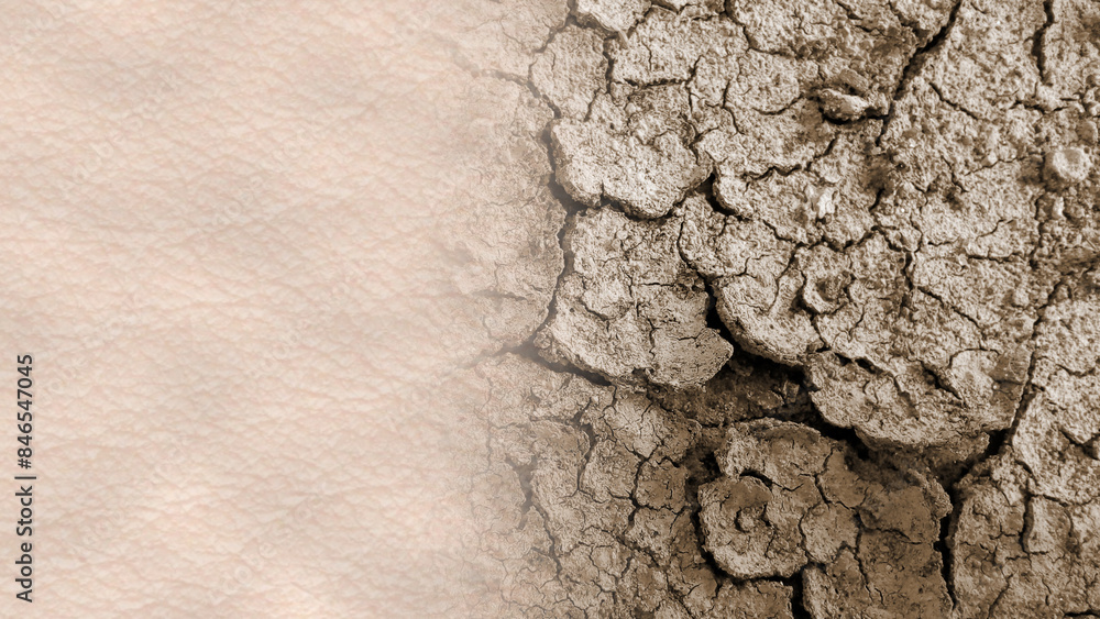 Dry dehydrated skin concept illustration. Comparison of normal healthy ...