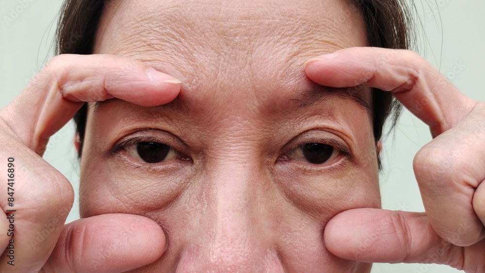 portrait the fingers holding the flabbiness adipose sagging, wrinkle ...