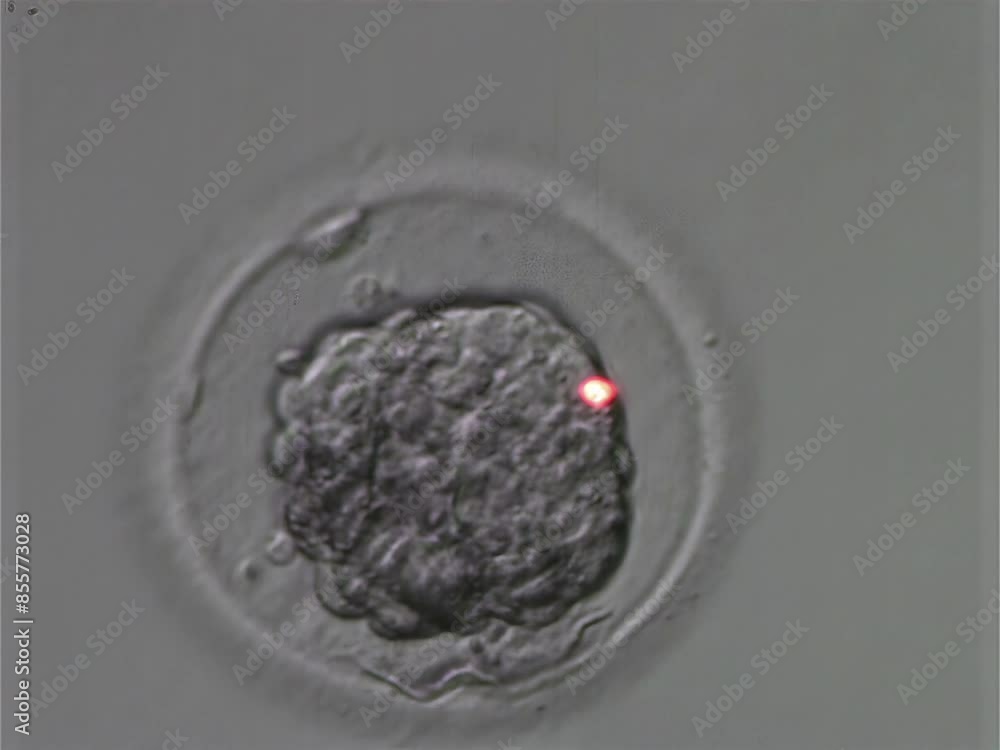 Inspecting the egg cell under a microscopic zoom. Studying the ...