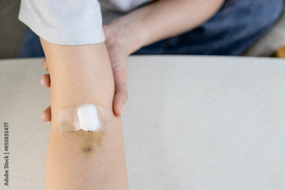 Arm of woman with bruise on foldable joint from needle,plaster and ... Arm of woman with bruise on foldable joint from needle,plaster and ...