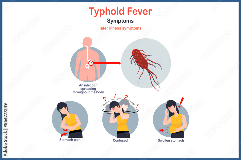 Medical illustration concept in flat style, later illness symptoms of ...