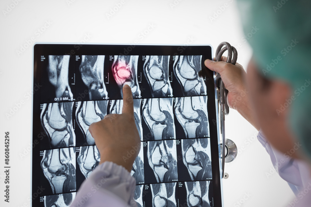 Doctor hand point patient bone x-ray film before surgery.Image MRI and CT scan at radiology ...