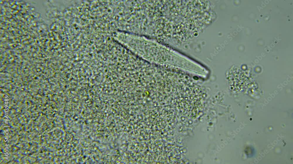 Bacteria, microorganisms, and plants in a water droplet under a ...