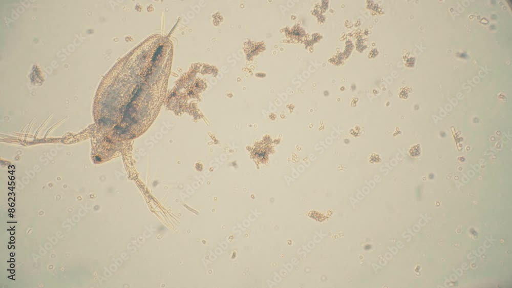This video shows a microscopic view of a water flea. You can see its ...